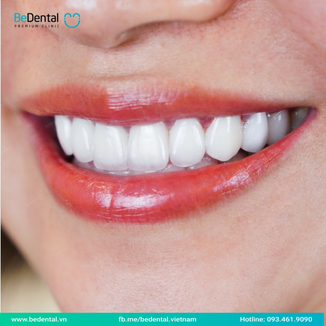 VẬN MỆNH CỦA NGƯỜI CÓ RĂNG ĐỀU HẠT BẮP NHƯ THẾ NÀO? – Be Dental