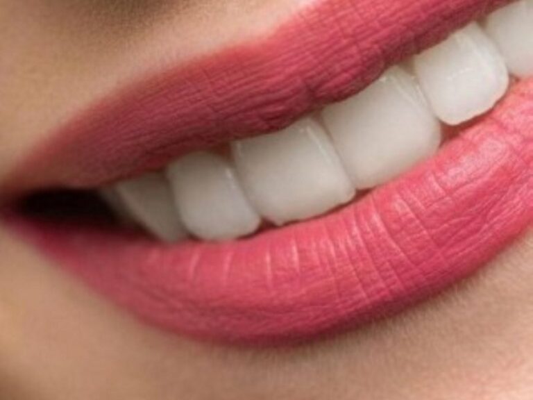 Tổng hợp 70+ hình ảnh răng đẹp, nụ cười đẹp chuẩn nha khoa – Nha Khoa ...