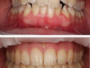 Tổng hợp 70+ hình ảnh răng đẹp, nụ cười đẹp chuẩn nha khoa – Nha Khoa ...