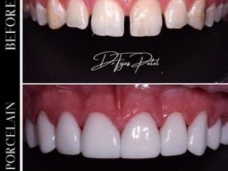 Tổng hợp 70+ hình ảnh răng đẹp, nụ cười đẹp chuẩn nha khoa – Nha Khoa ...