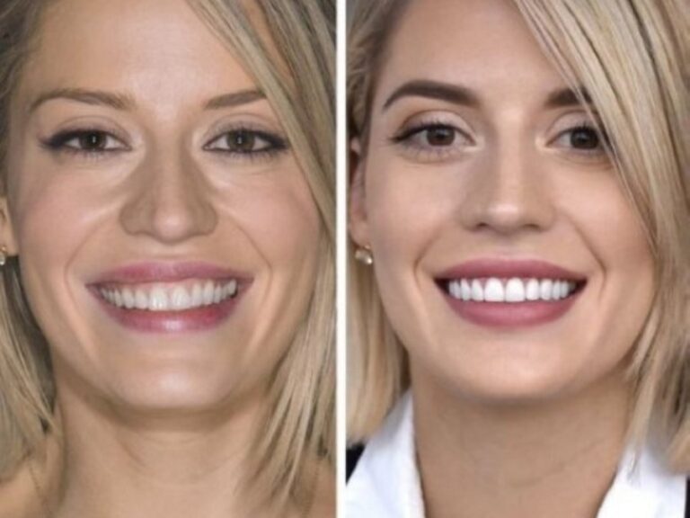 Tổng hợp 70+ hình ảnh răng đẹp, nụ cười đẹp chuẩn nha khoa – Nha Khoa ...