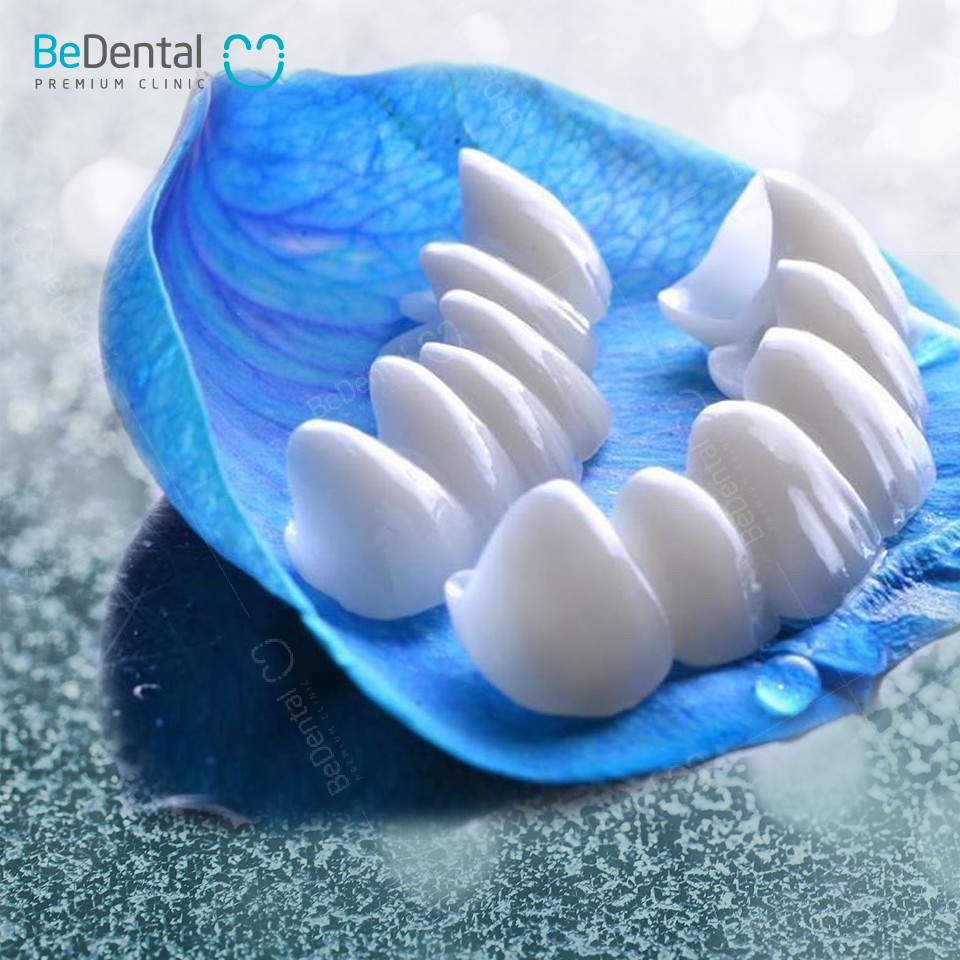 ALL YOU NEED TO KNOW ABOUT VENUS PORCELAIN DENTAL CROWNS – Nha Khoa ...