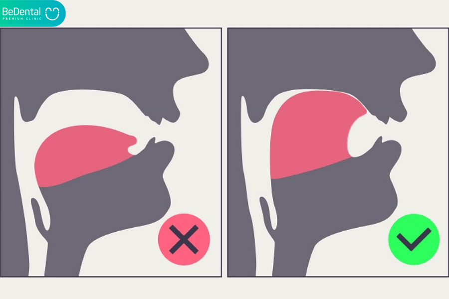 Phương pháp mewing là gì? 1 số lưu ý với những người mới – Nha Khoa BeDental