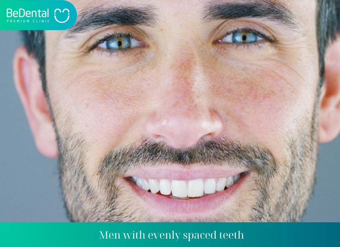 What is Evenly spaced teeth – What is the fate of a person with evenly ...