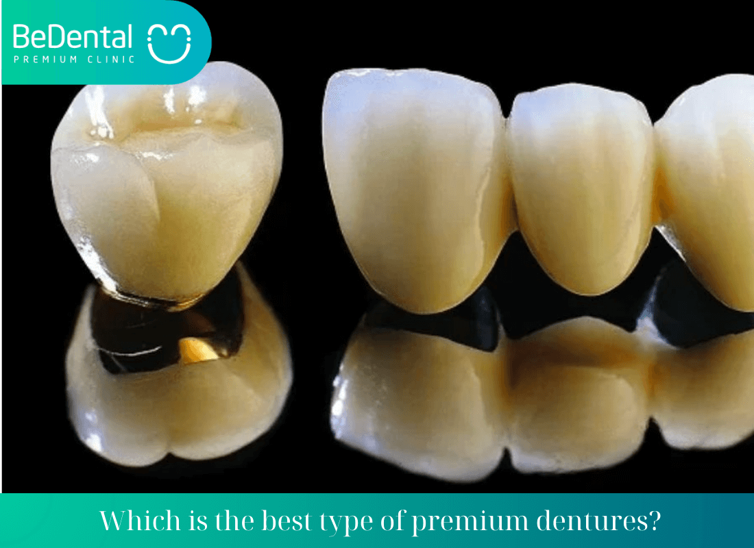 Common Types of Premium Dentures – Cost of Premium Dentures – Nha Khoa ...